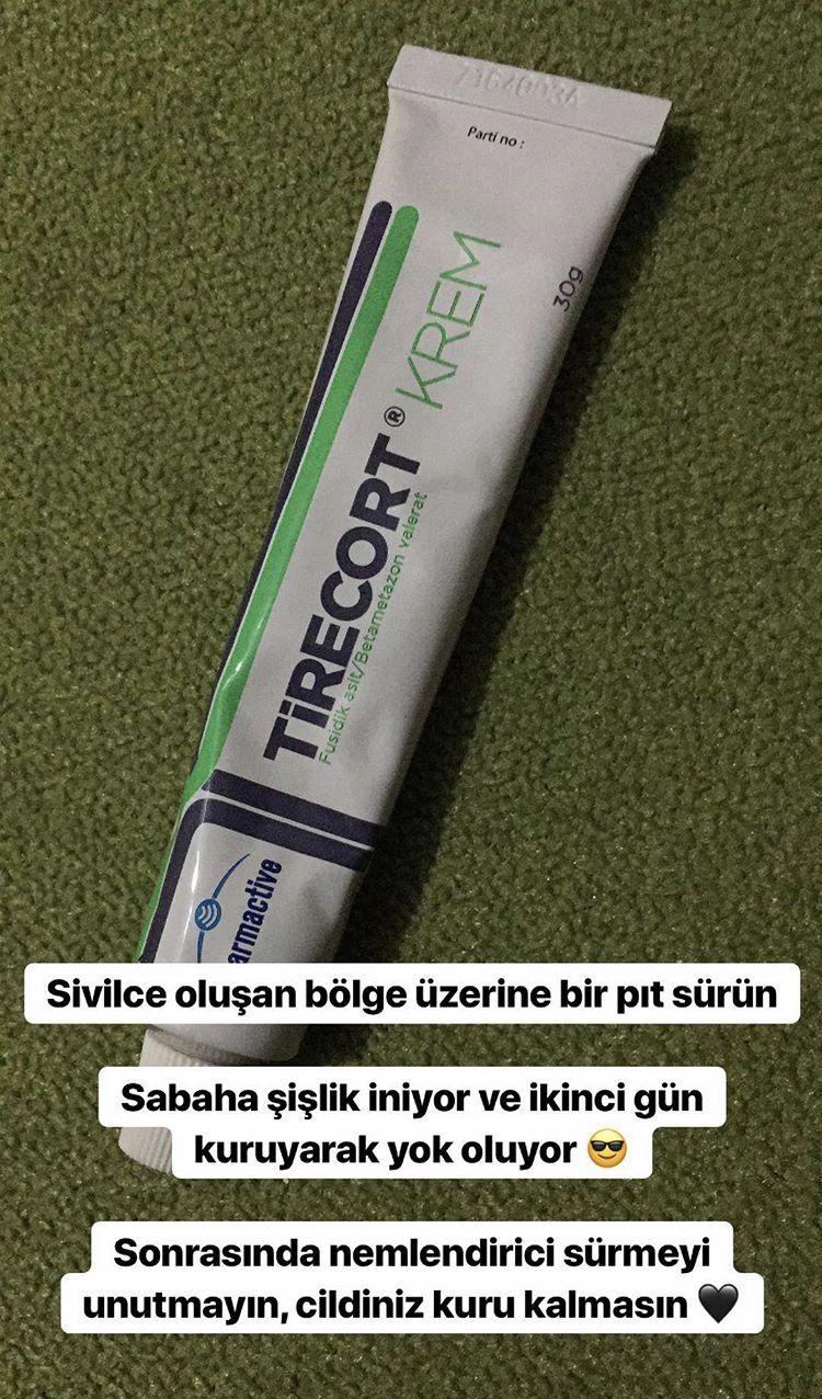 Tirecort Krem Ne İşe Yarar? Nasıl Kullanılır?